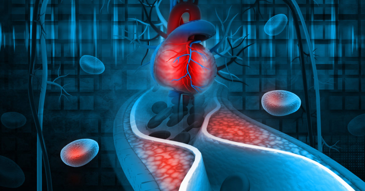 High cholesterol • Heart Research Institute NZ